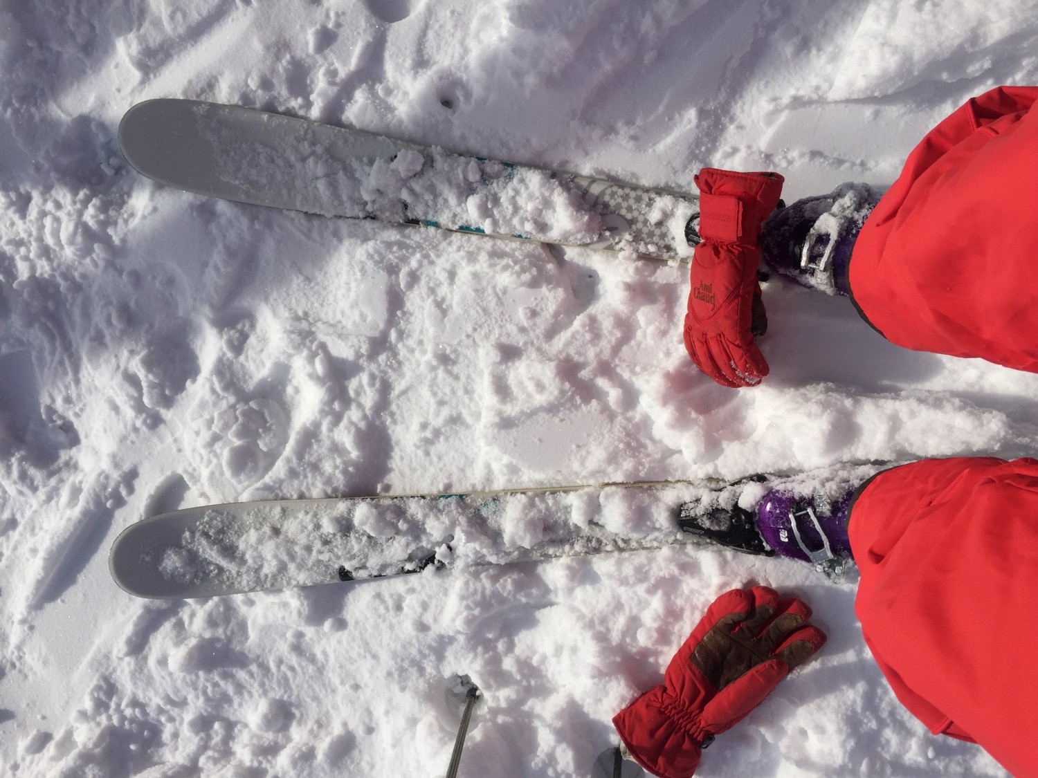 Learning to walk again - Thrive Global