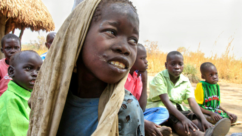 What is Cohen Syndrome? - Thrive Global